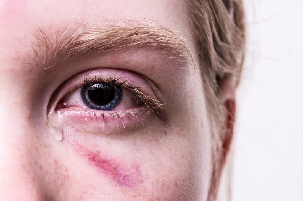 Signs of High-Altitude Sickness, Treatment and Prevention | Base Camp ...